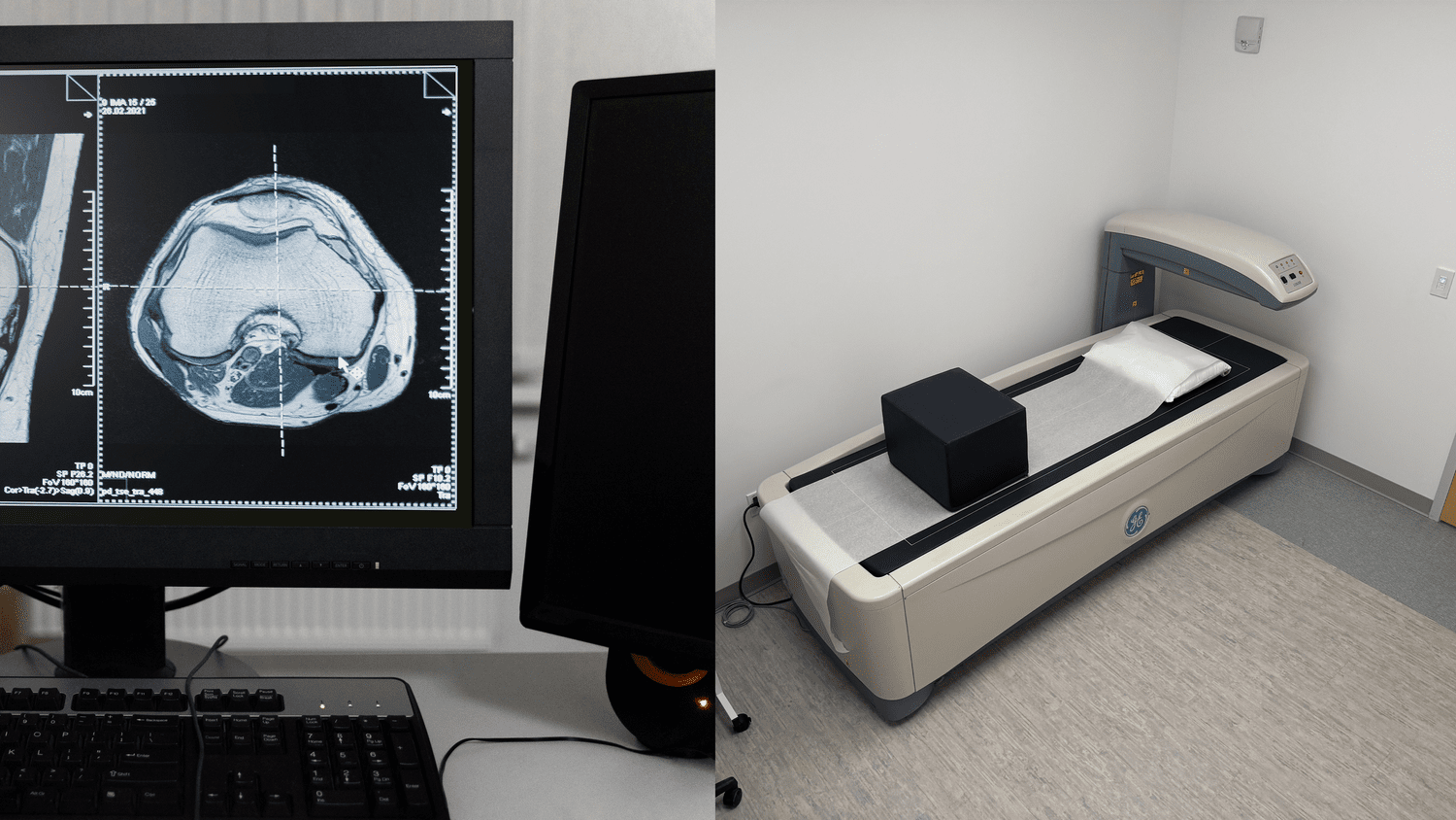 Strengthening Your Foundation: Bone Health, Body Composition, and the ...