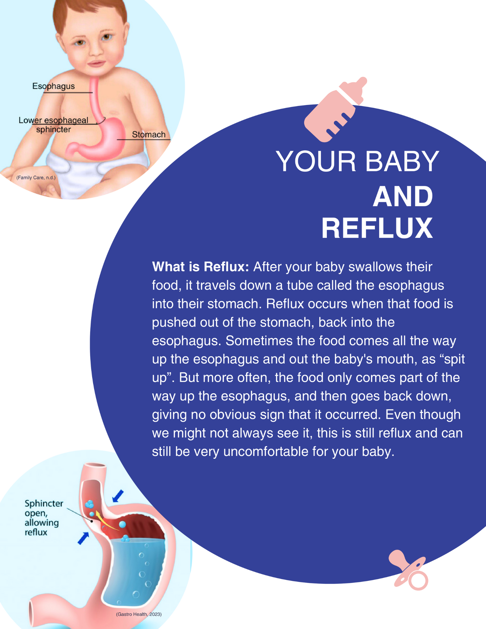 Refluxes in Feeding — Ability Innovations
