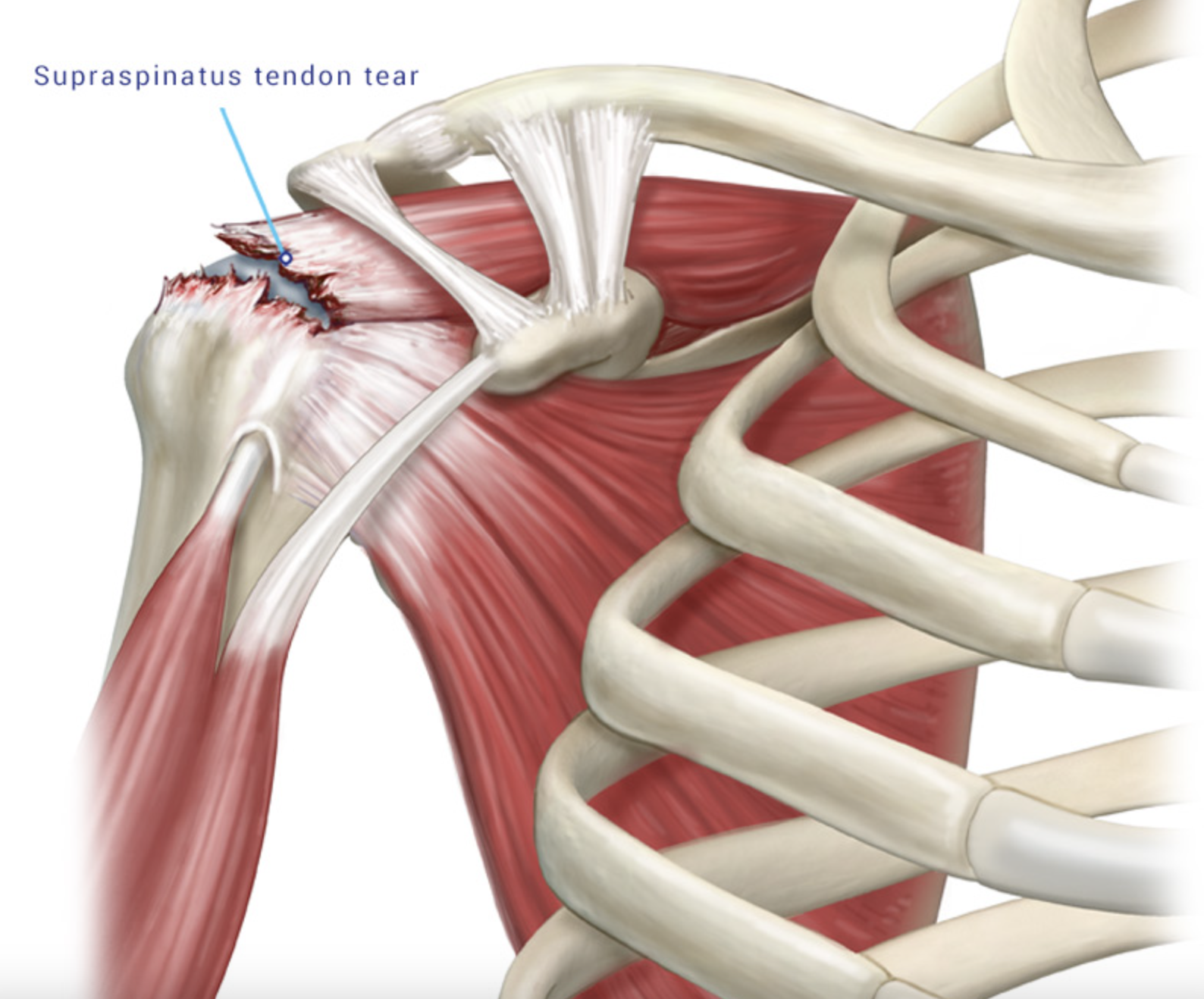 Dr. Marion Herring - Shoulder & Knee - Richmond Shoulder and Knee Surgeon