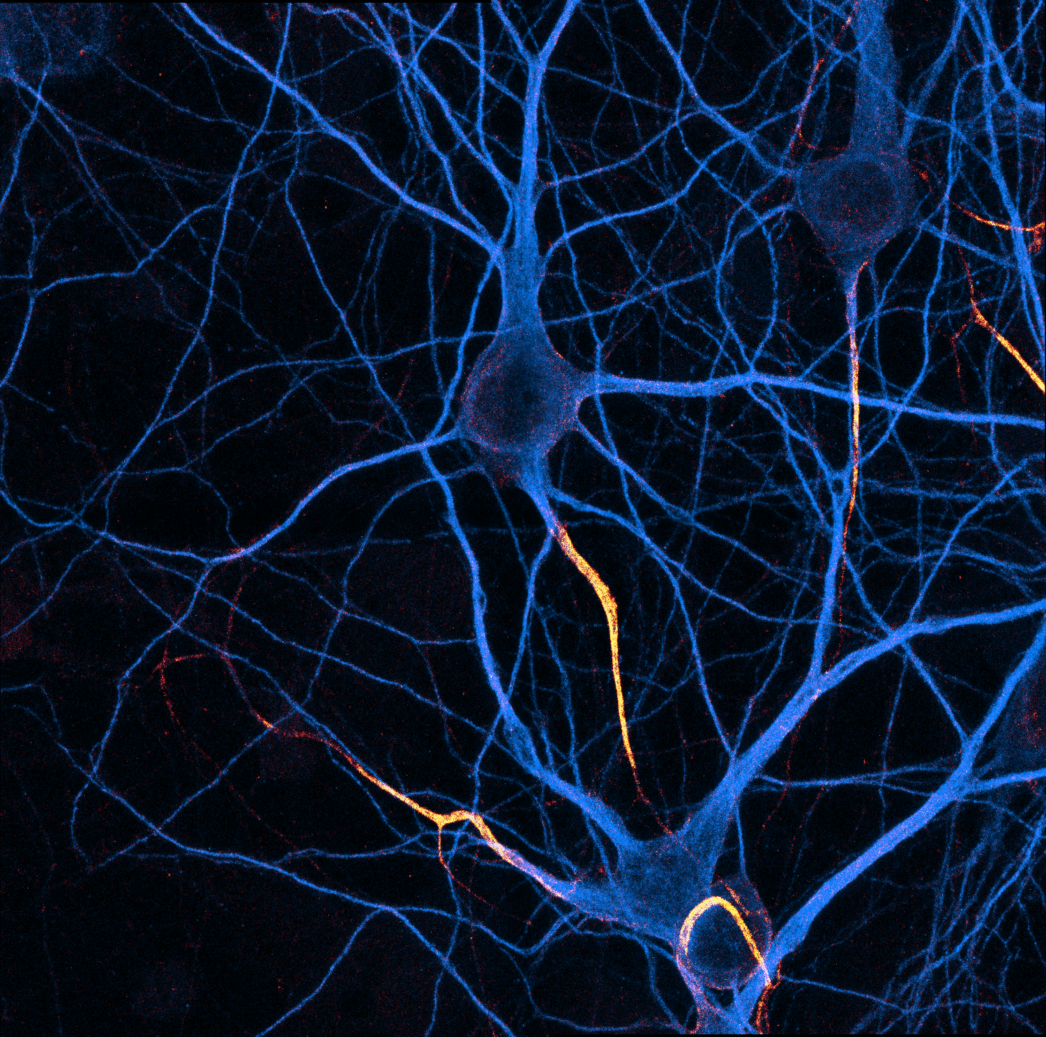 Axon Initial Segment | Explore Neuroscience Advances Today ...
