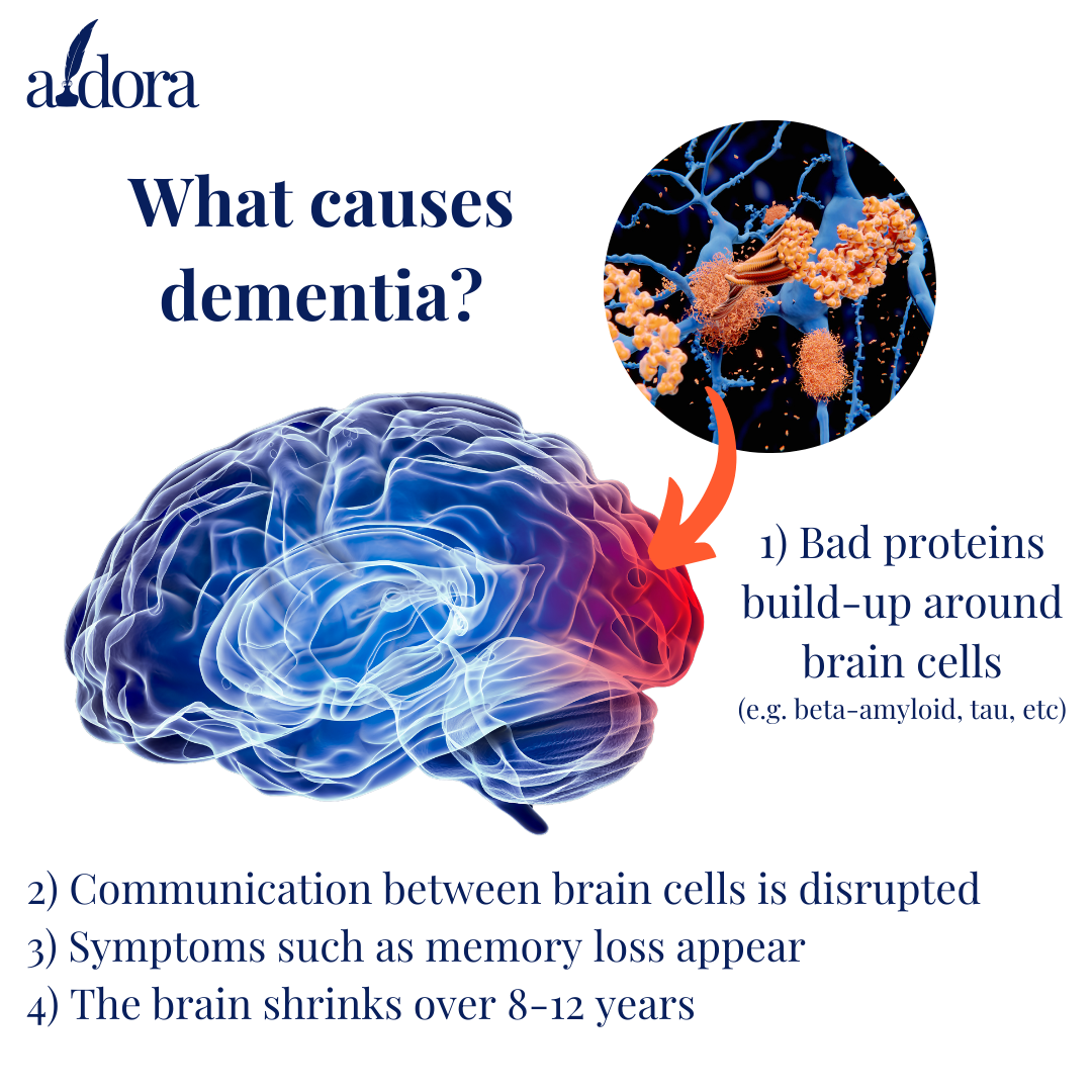 Medical Minute: What causes dementia? | aldora