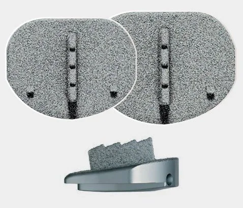 Prodisc®L Anterior Lumbar Total Disc Replacement — Invictus Medical