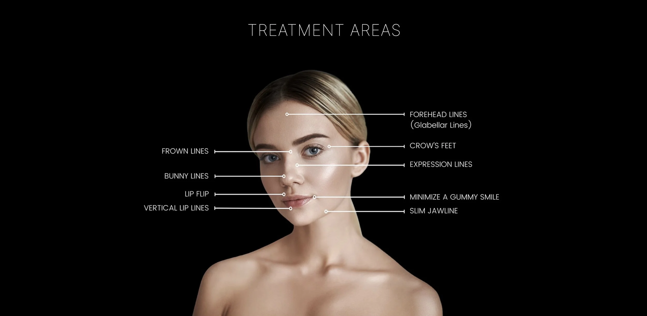 Botox — The Radiance MD