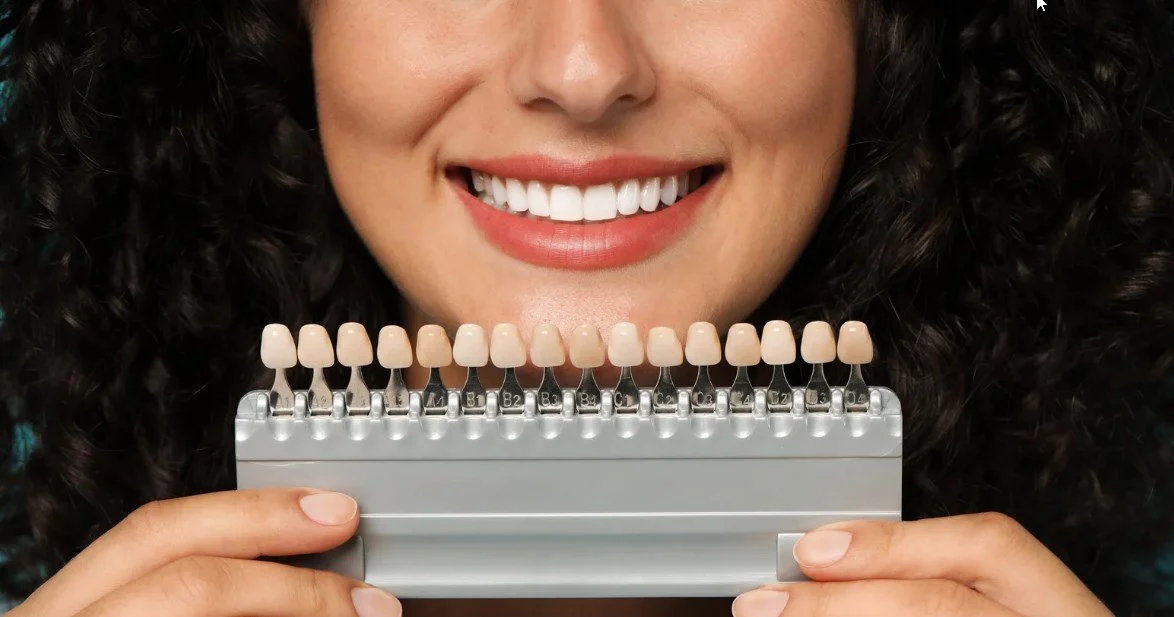Can Veneers Fix Crooked Teeth? Understanding the Cosmetic Solutions ...