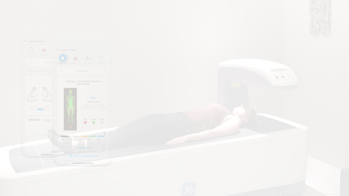 AI-Enhanced DEXA Body Scans in Atlanta, Georgia — DexaFit Atlanta