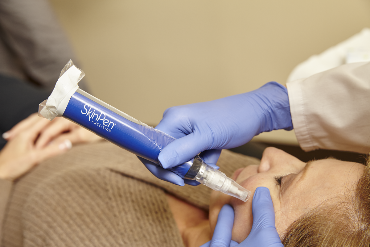 Professional Microneedling — Gold Standard Skin