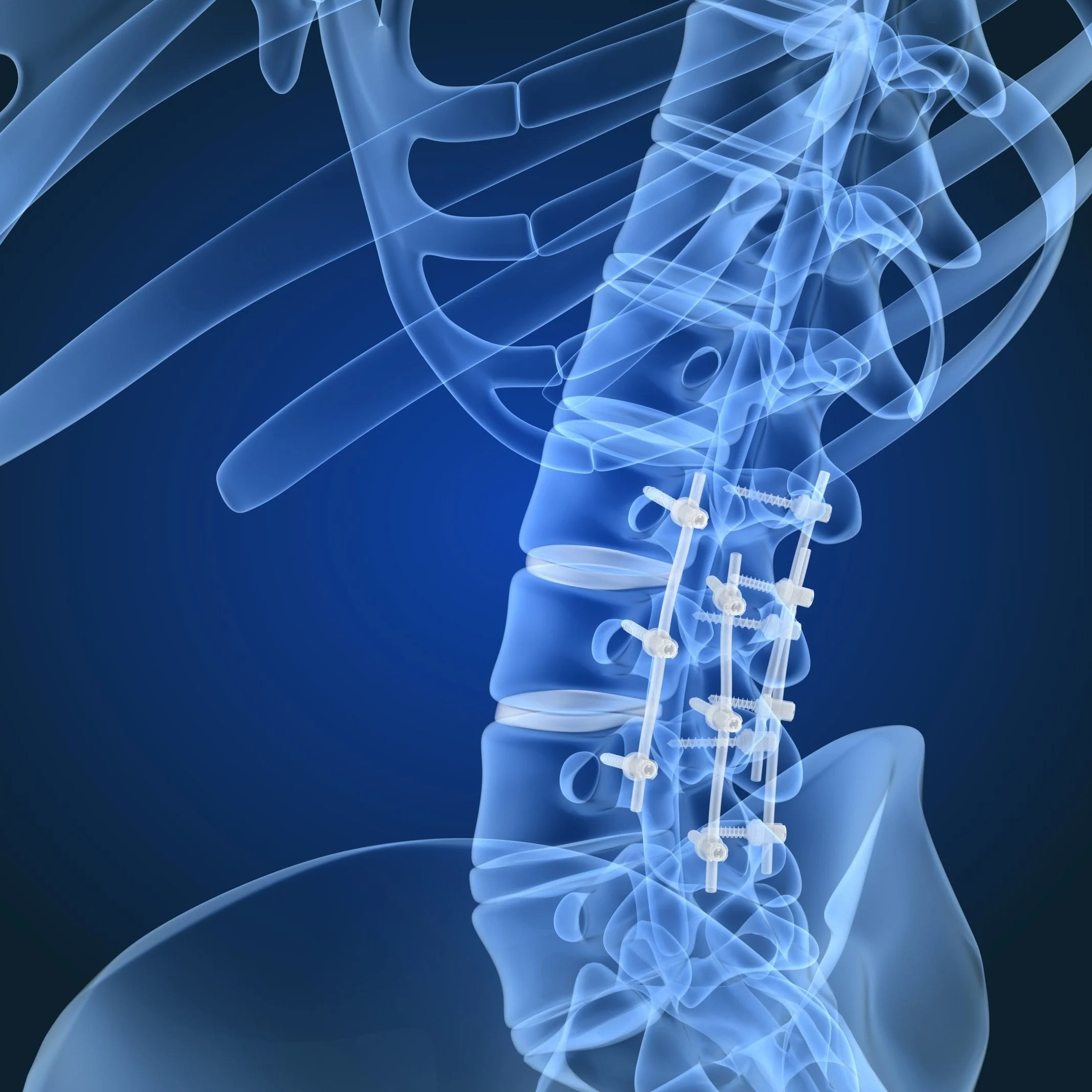 Markets — Precinmac