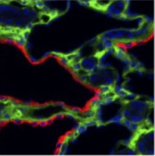 Zhaoxia Sun Lab Research — Sun Lab at Yale
