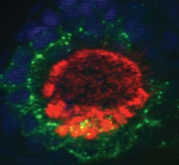 Zhaoxia Sun Lab Research — Sun Lab at Yale