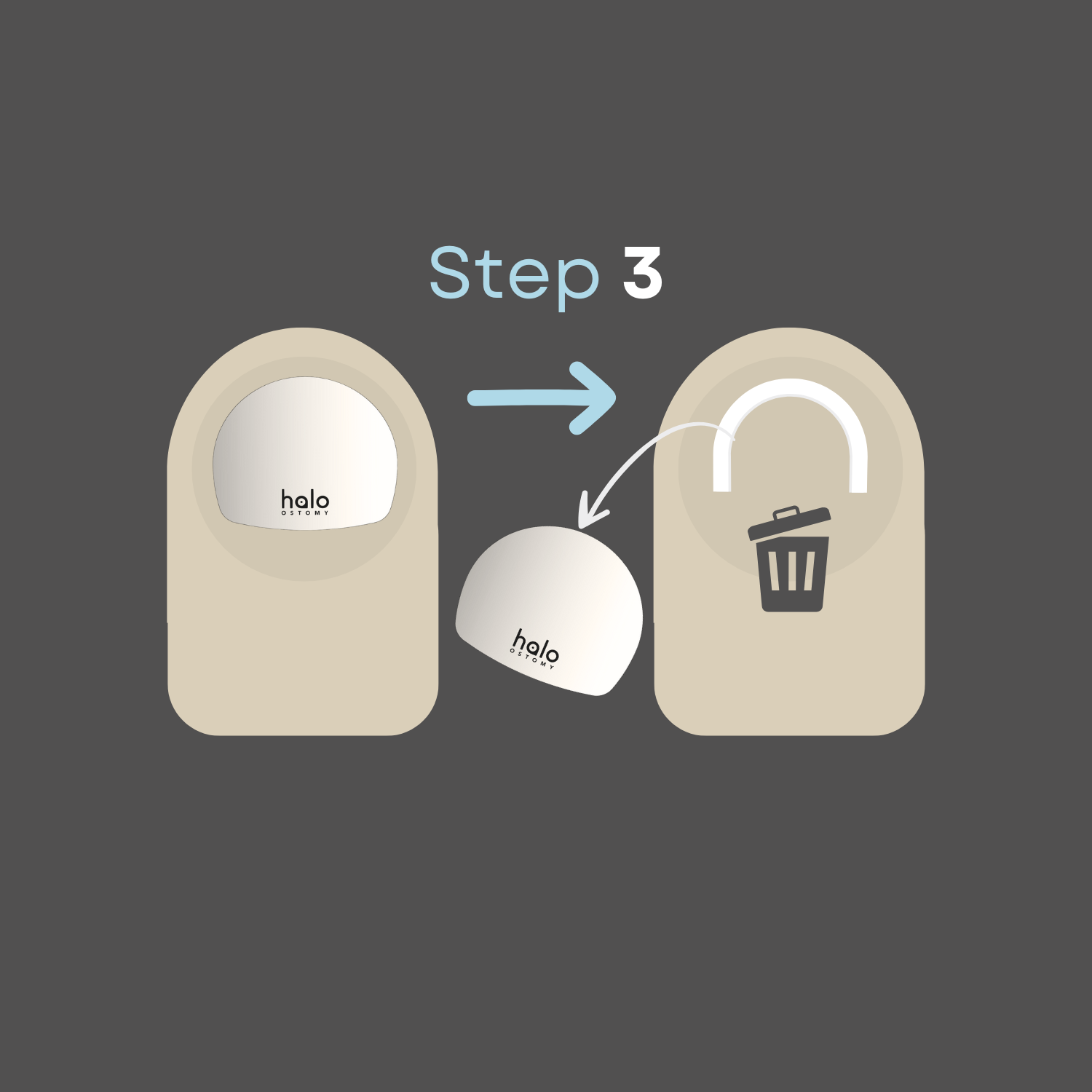 Halo Ostomy Stoma Guard - Stoma Guards for Ostomy, Colostomy ...