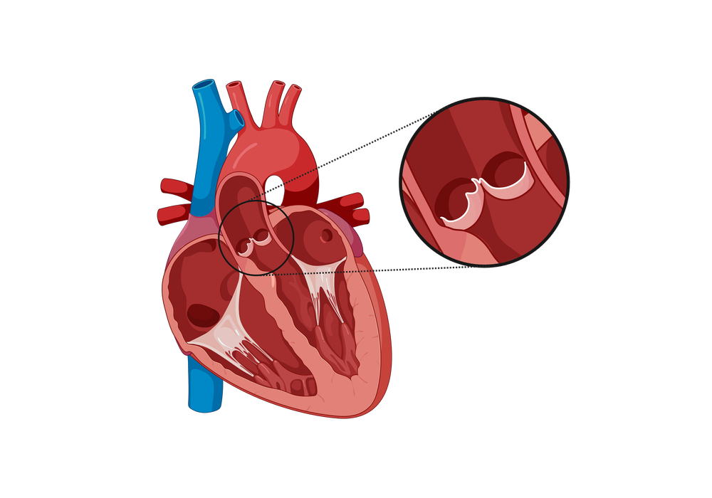 Aortic Root — YOUR ORGAN AORTA