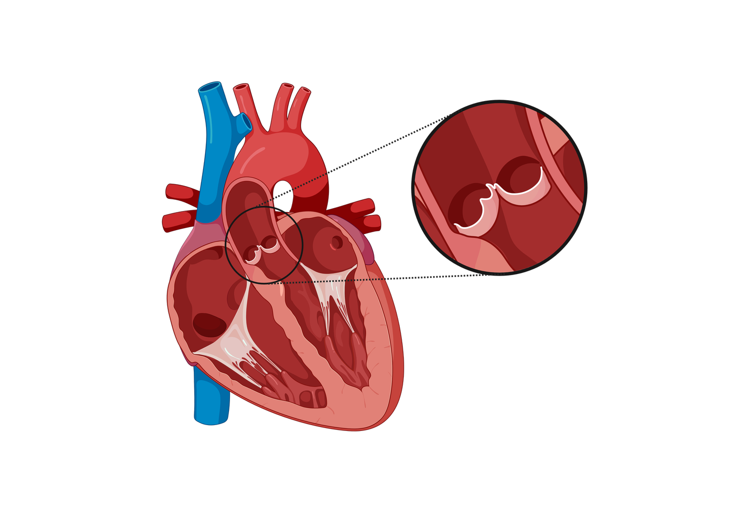 Aortic Root — YOUR ORGAN AORTA