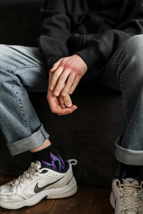 Understanding Self-Harm in Teens and How Therapists Can Help - Brandon ...