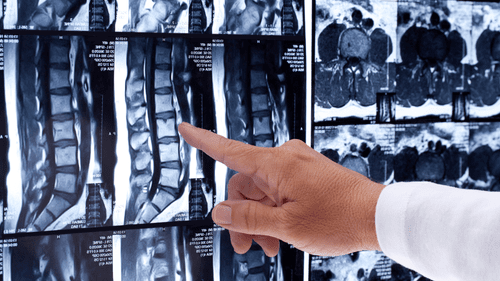 Spine Care Specialists of Alaska – Minimally Invasive Spine Surgery in ...