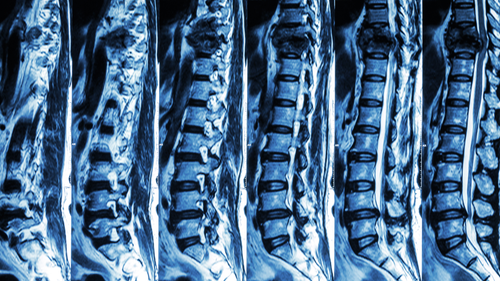 Spine Care Specialists of Alaska – Minimally Invasive Spine Surgery in ...
