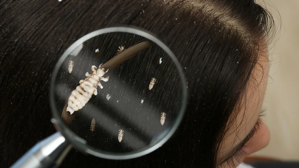 Professional Lice Treatment in Houston | Premier Lice Spa