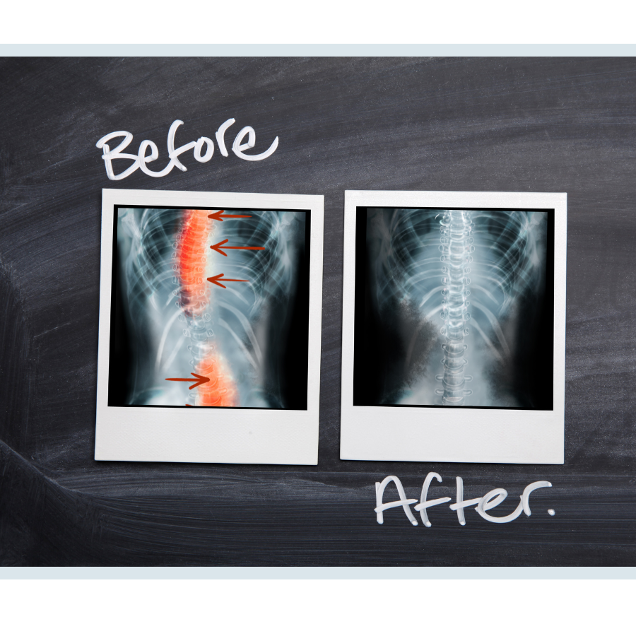 Powered by Chiropractic