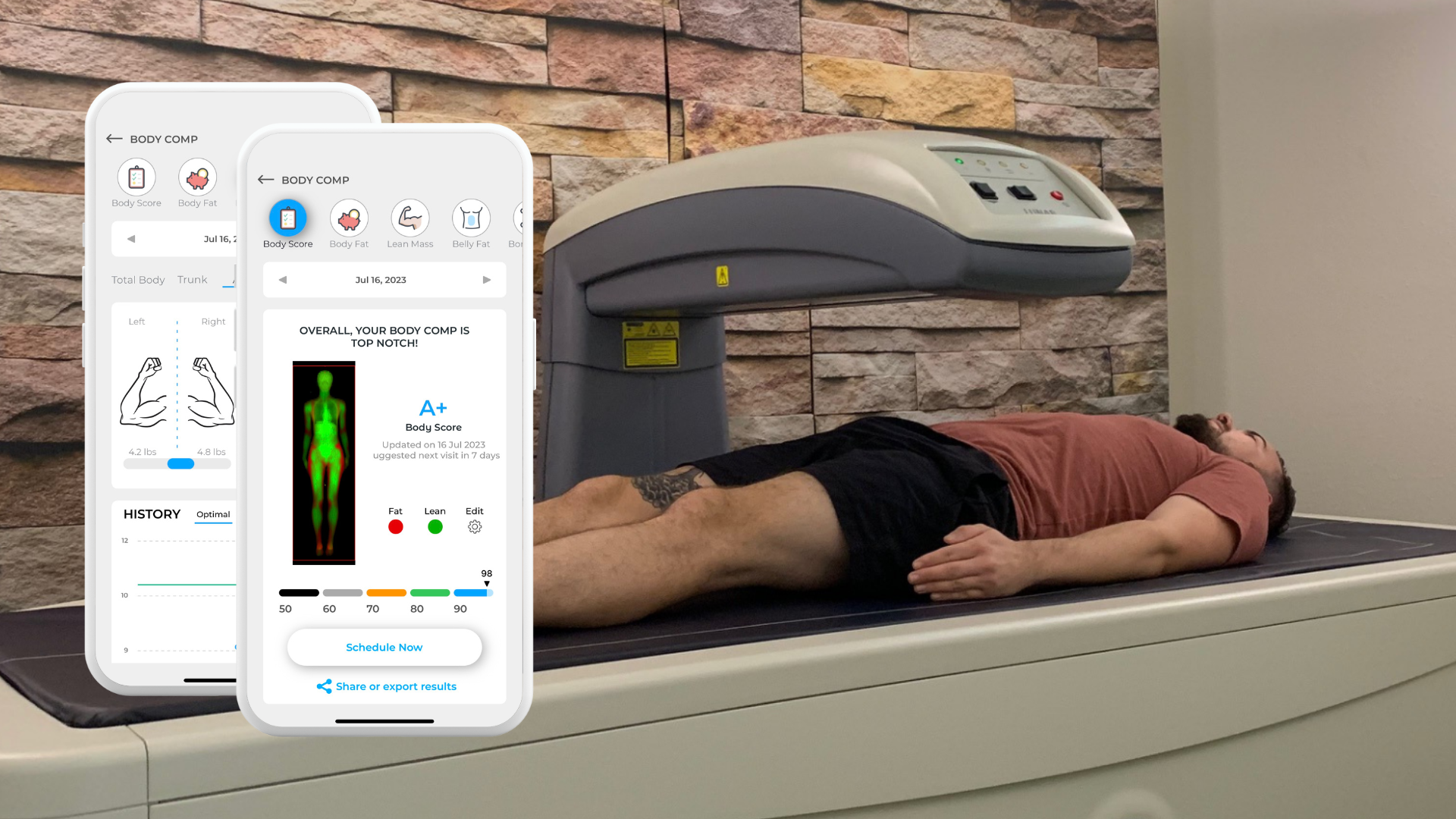 AI-Enhanced DEXA Body Scans in Broward, Florida — DexaFit Broward