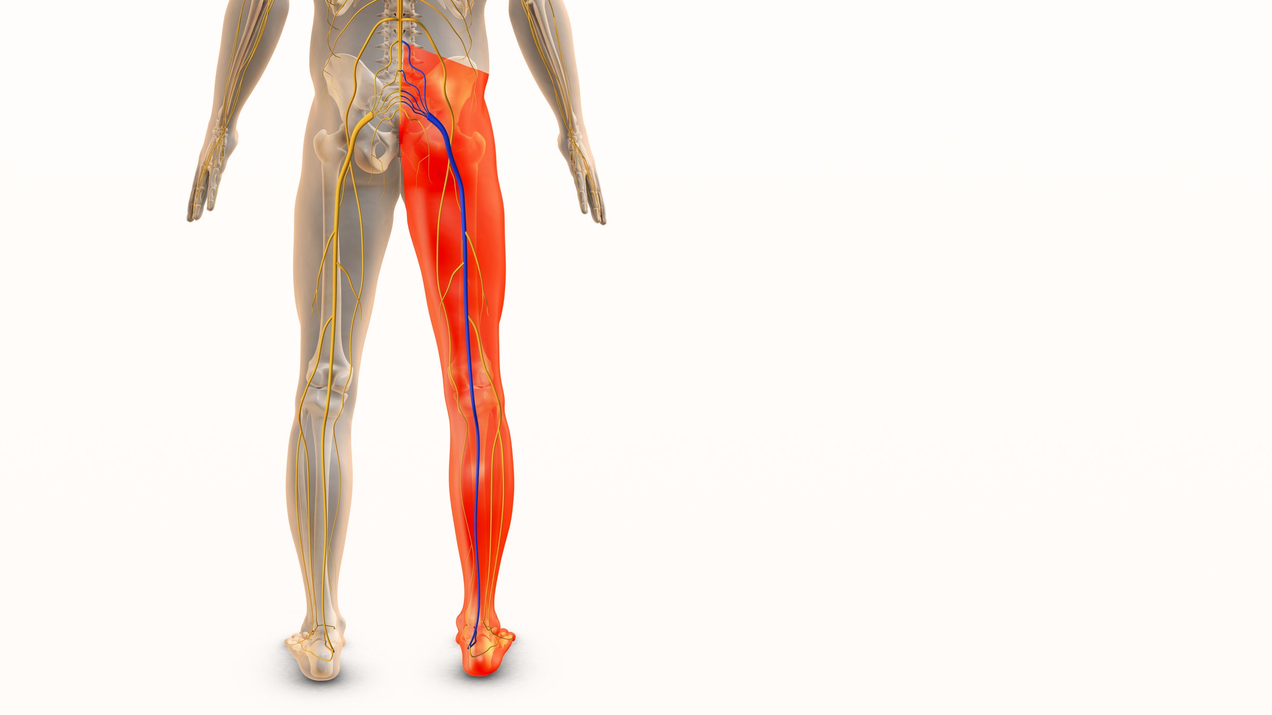 How Acupuncture can help with Sciatica — Sunstone Medicine