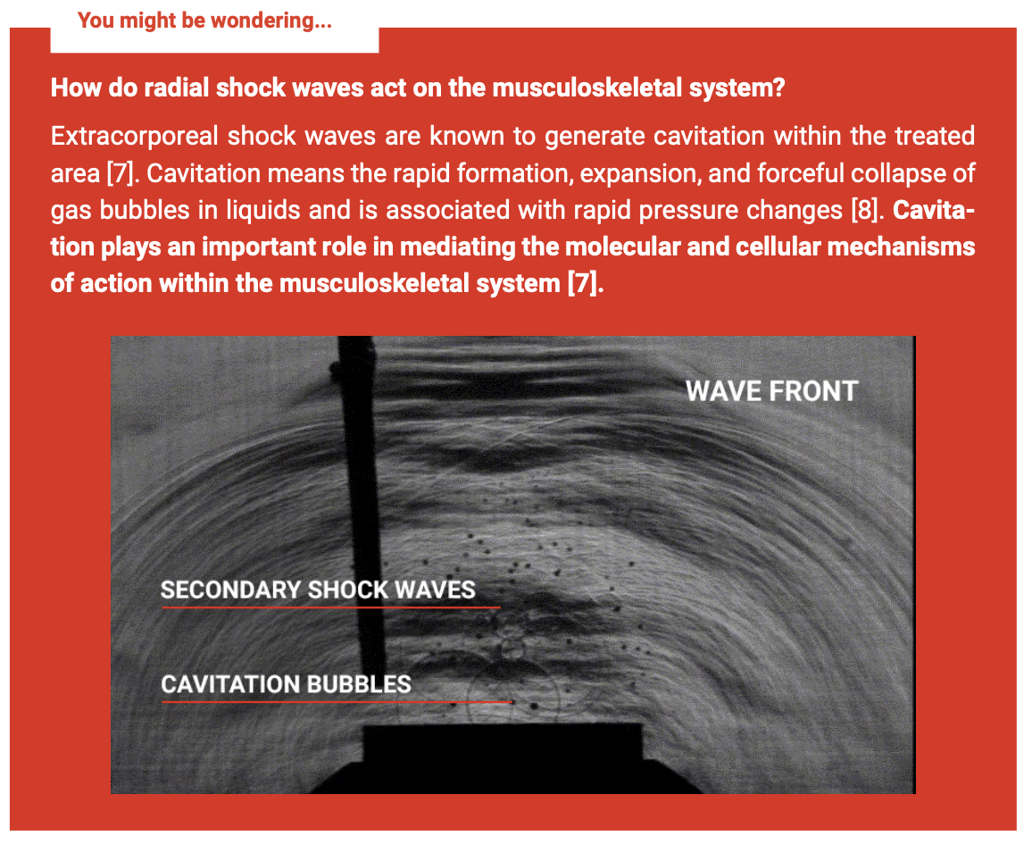 What is Extracorporeal shockwave therapy, and can it help you ...