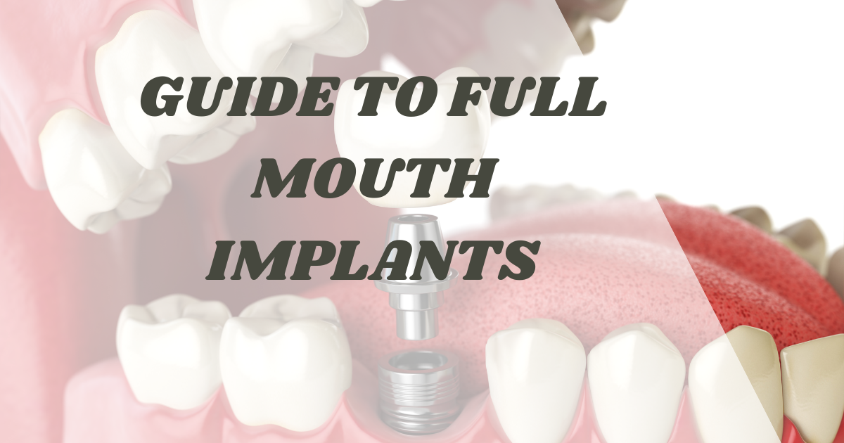 How to Care for Full Mouth Dental Implants — DR GRAY DENTISTRY