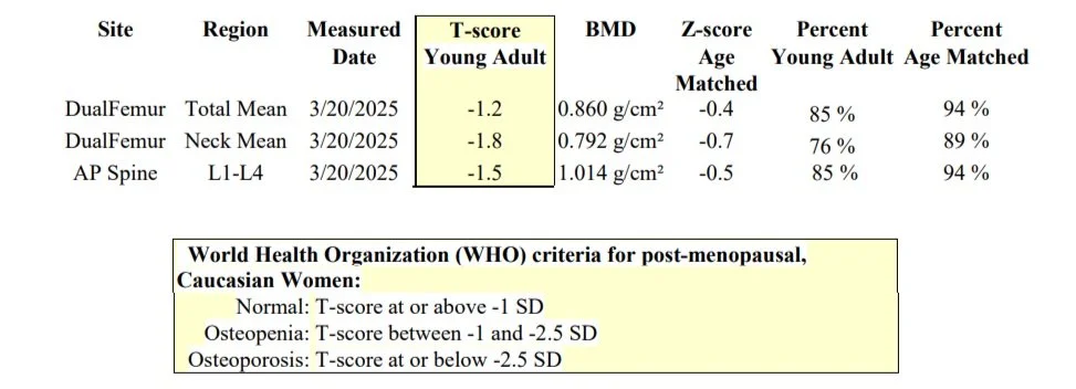 What is a T-score, and what does it mean? — Andrea Trombley PT Health & Wellness