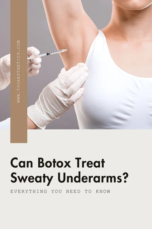 Botox for Sweaty Underarms: Understanding and Managing Excessive ...