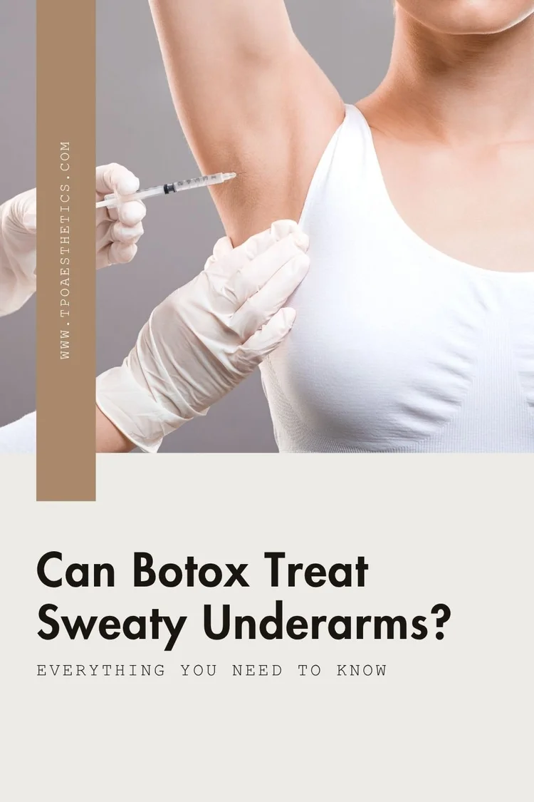 Botox for Sweaty Underarms: Understanding and Managing Excessive ...