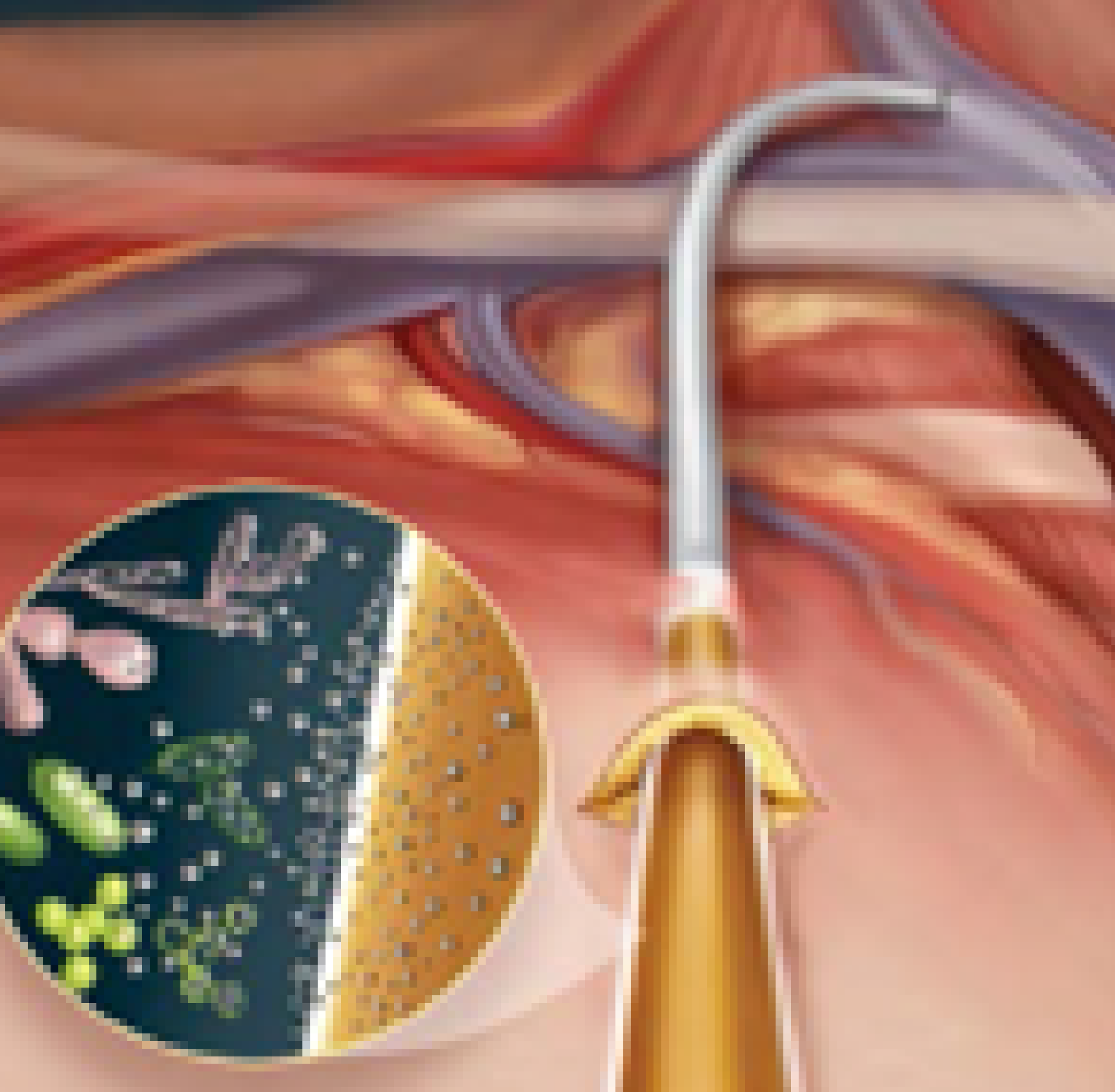 Catéter Palindrome Para Diálisis Crónica — Tecrom Renal Care