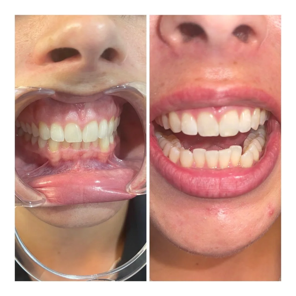 Pristine Pearls Whitening