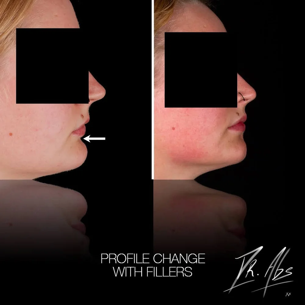 Cosmetic Rx — Dr. Abs
