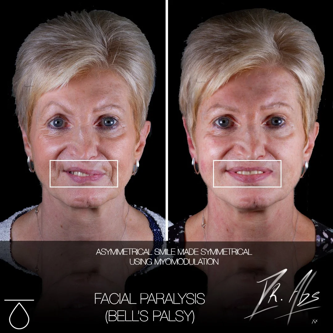 Store — Dr. Abs