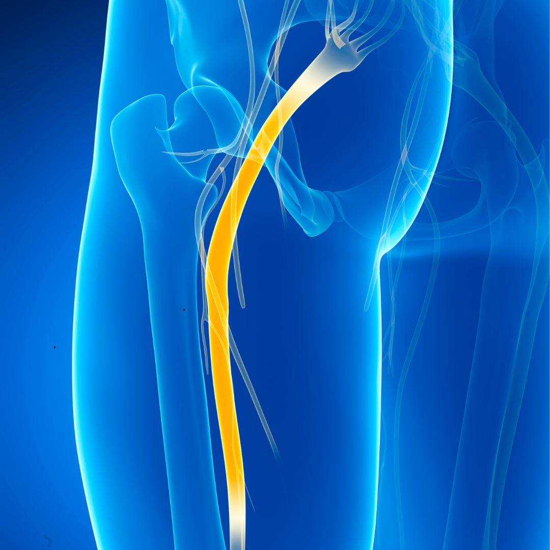 Radiculopathy — Suba health and wellness clinic