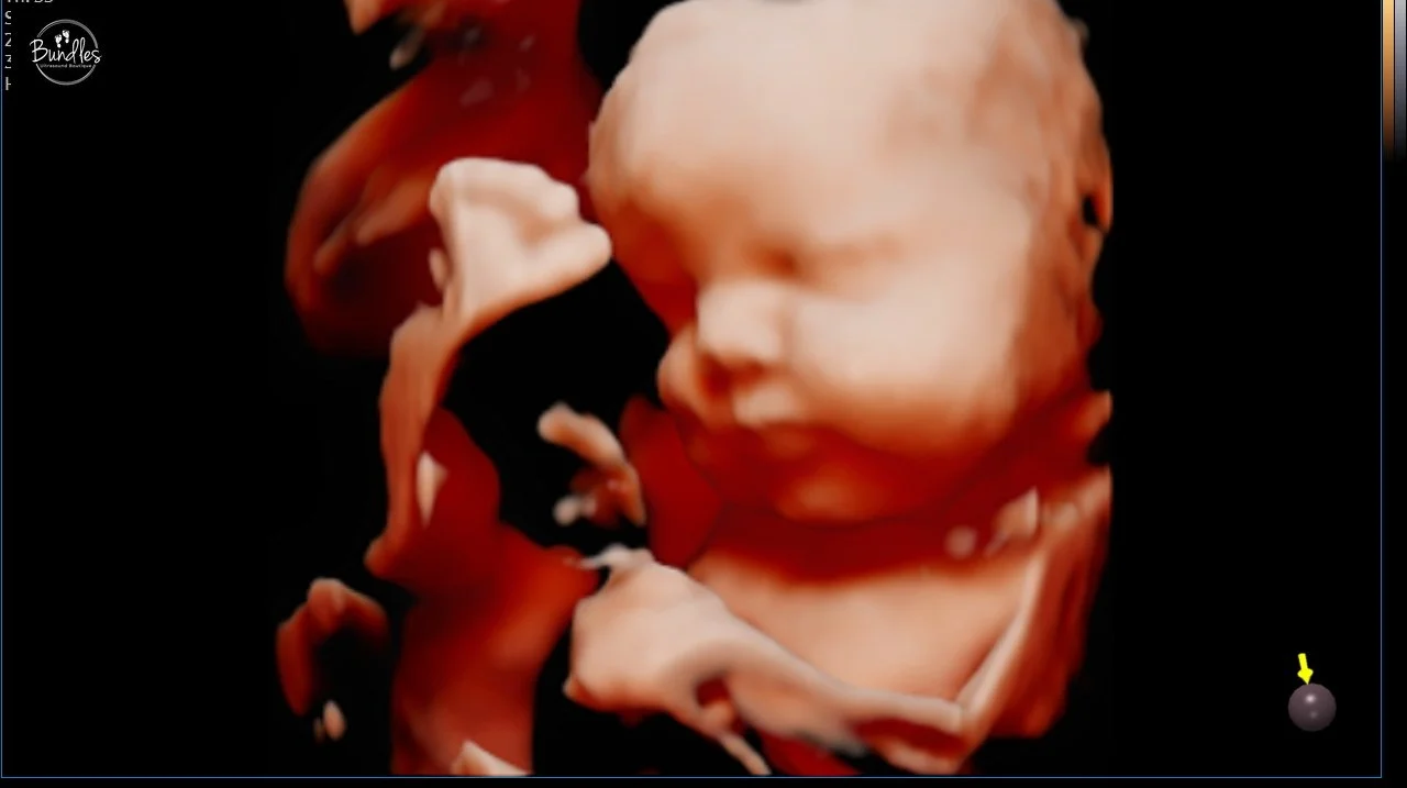 Bundles Ultrasound Boutique | 3D/4D Ultrasound Photography