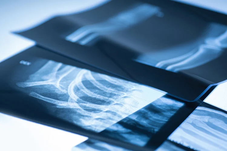 Imaging & Radiology | Discover Precise Imaging Today — Citizens Medical ...