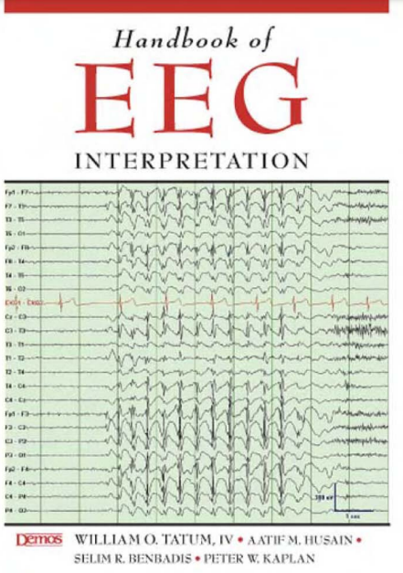 Resources Brainstorm Board Prep