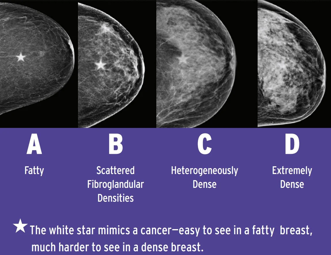 Decoding Breast Density: Risks, Awareness, & Action Guide