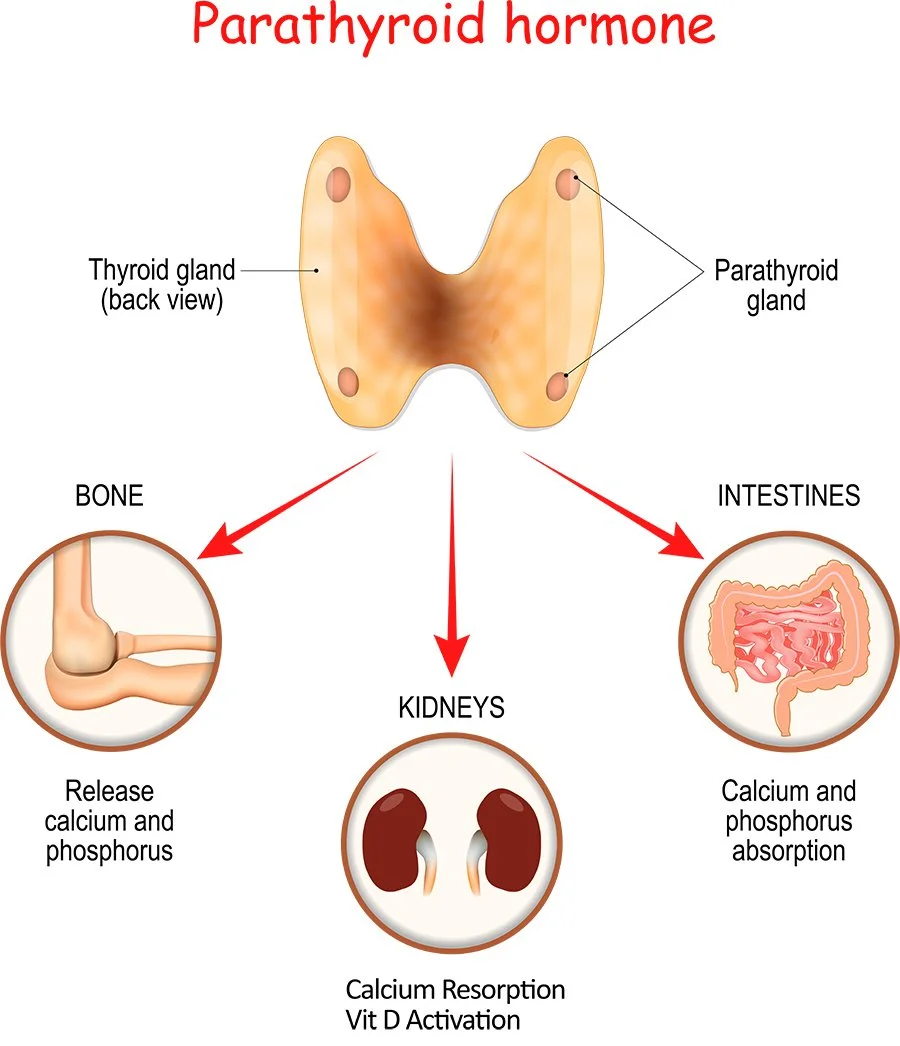 Primary Hyperparathyroidism: Symptoms, Diagnosis, and Treatment — DR ...