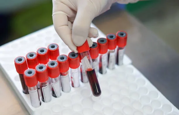 Powassan Virus: Symptoms, Treatment, and Long-Term Management — Lyme Advise