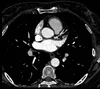 Jae Hyung Cho, MD Cardiology