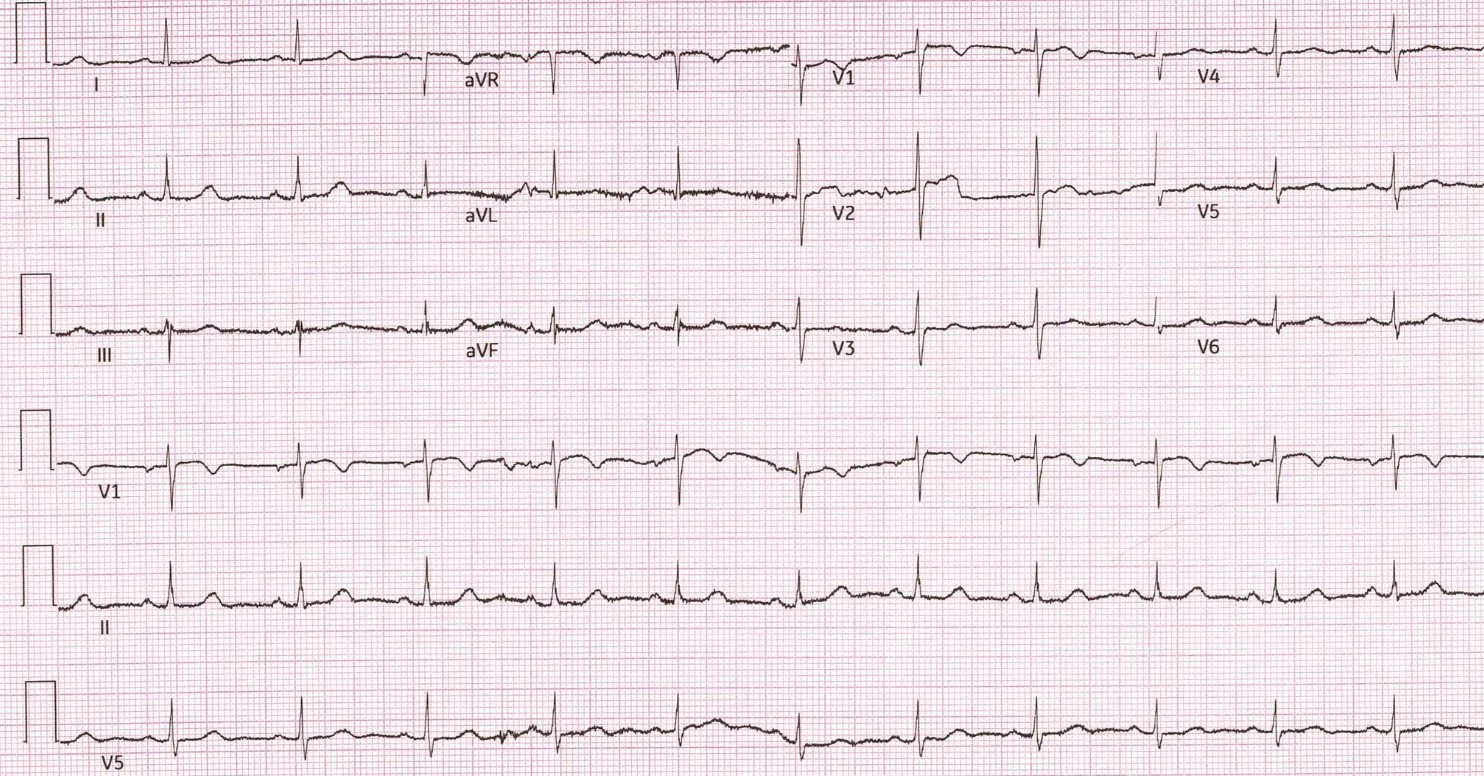 Jae Hyung Cho, MD Cardiology