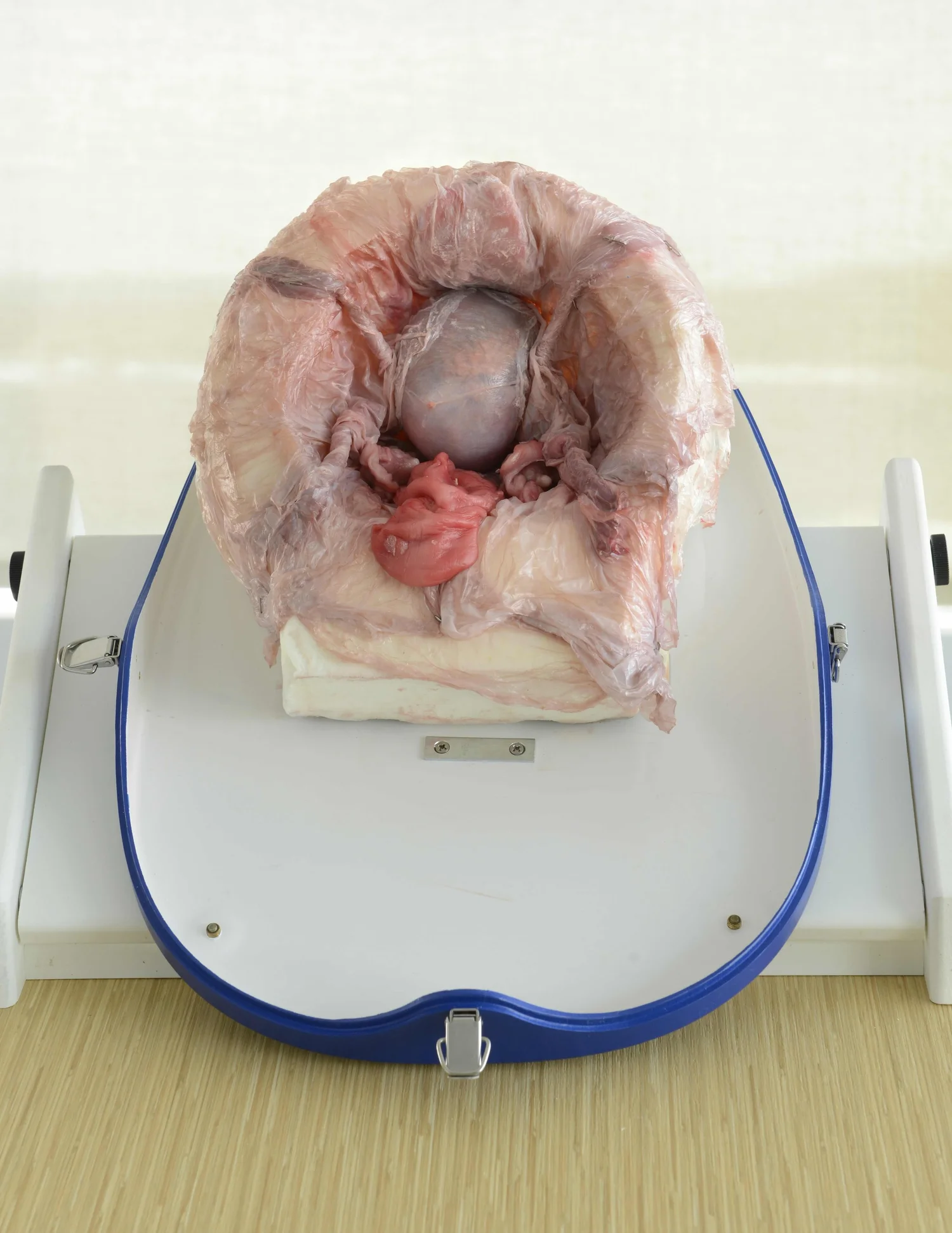 Surgical Models Like No Other — Surgical Modeling Solutions