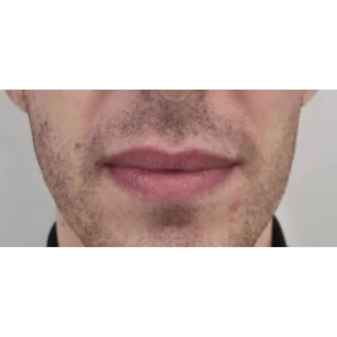 Dr. Toro Aesthetics - Doctor-Led Clinic