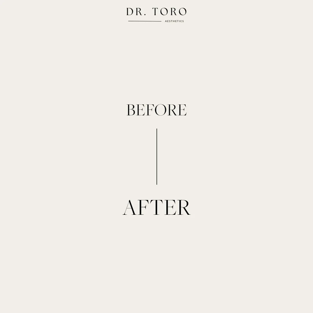 Dr. Toro Aesthetics - Doctor-Led Clinic