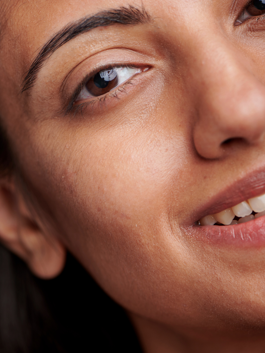 Face Treatments | Elevate Recovery and Medspa — Elevate Recovery + Medspa