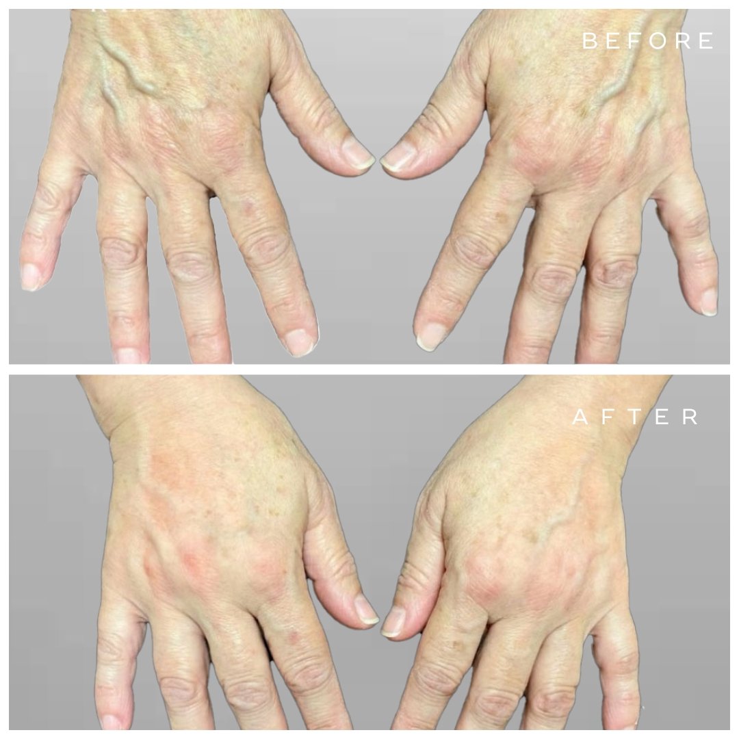 Before & After: Results | Laser Touch Medical Clinic