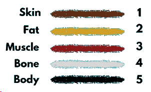 Retained Bullet Resources — The Bullet Related Injury Clinic (BRIC)