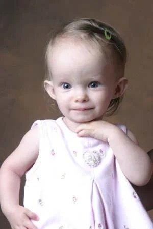 Russell Silver Syndrome — MAGIC Foundation for Children's Growth