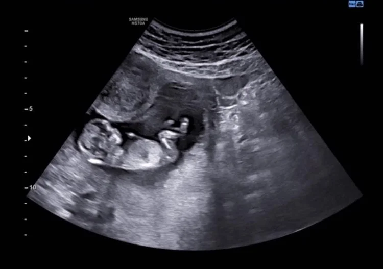 Baby Bumps & Beyond 4D Studio — Packages