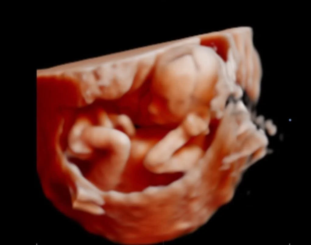 Baby Bumps & Beyond 4D Studio — Packages